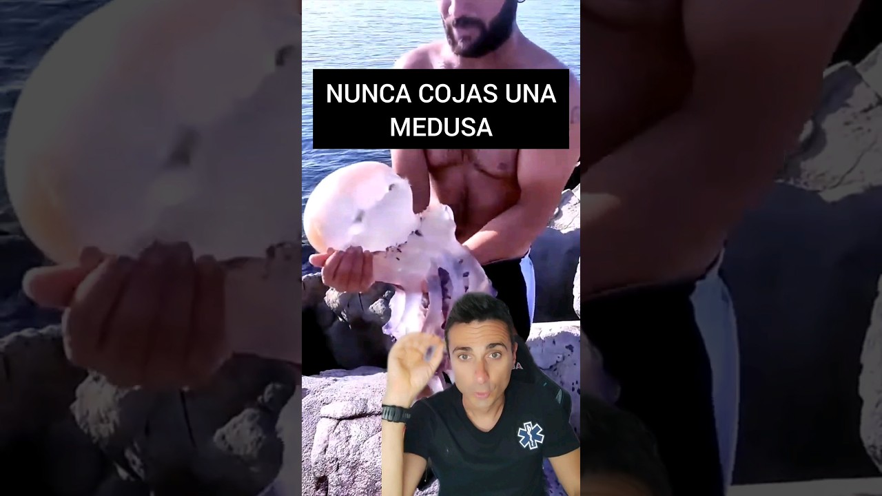 CACA NEGRA por TINTA de CALAMAR: Causas y Duración EXPUESTAS